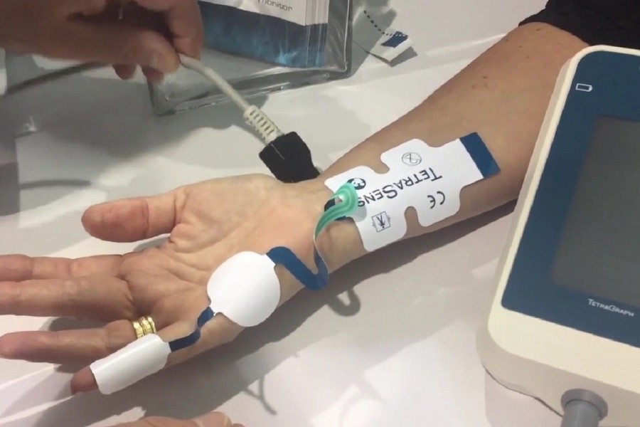 精準麻醉！非侵入式 TetraGraph 監視手術患者麻醉程度避免不當醫療風險｜數位時代 BusinessNext