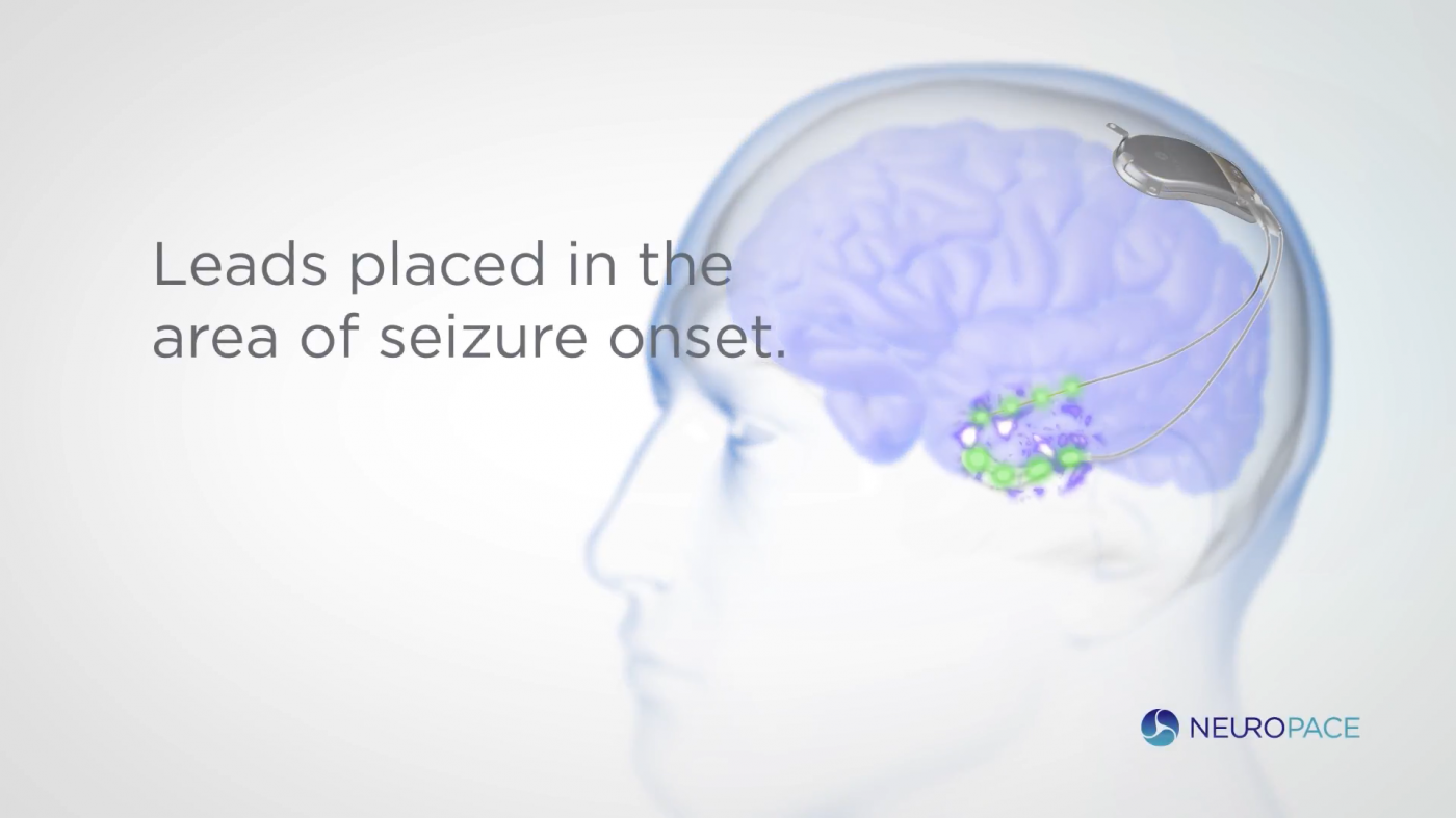 改變世界的創新！盤點2018年VC關注的十大領域新創（上）